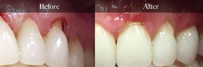 Before & After