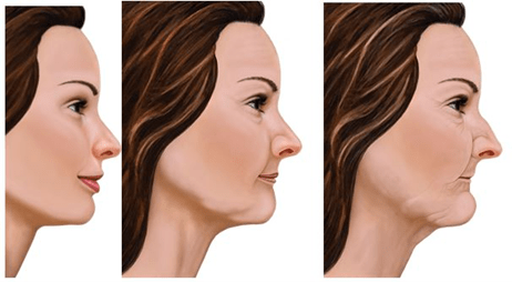 Ridge Preservation (Bone Grafting) After Tooth Extraction: When is it ...